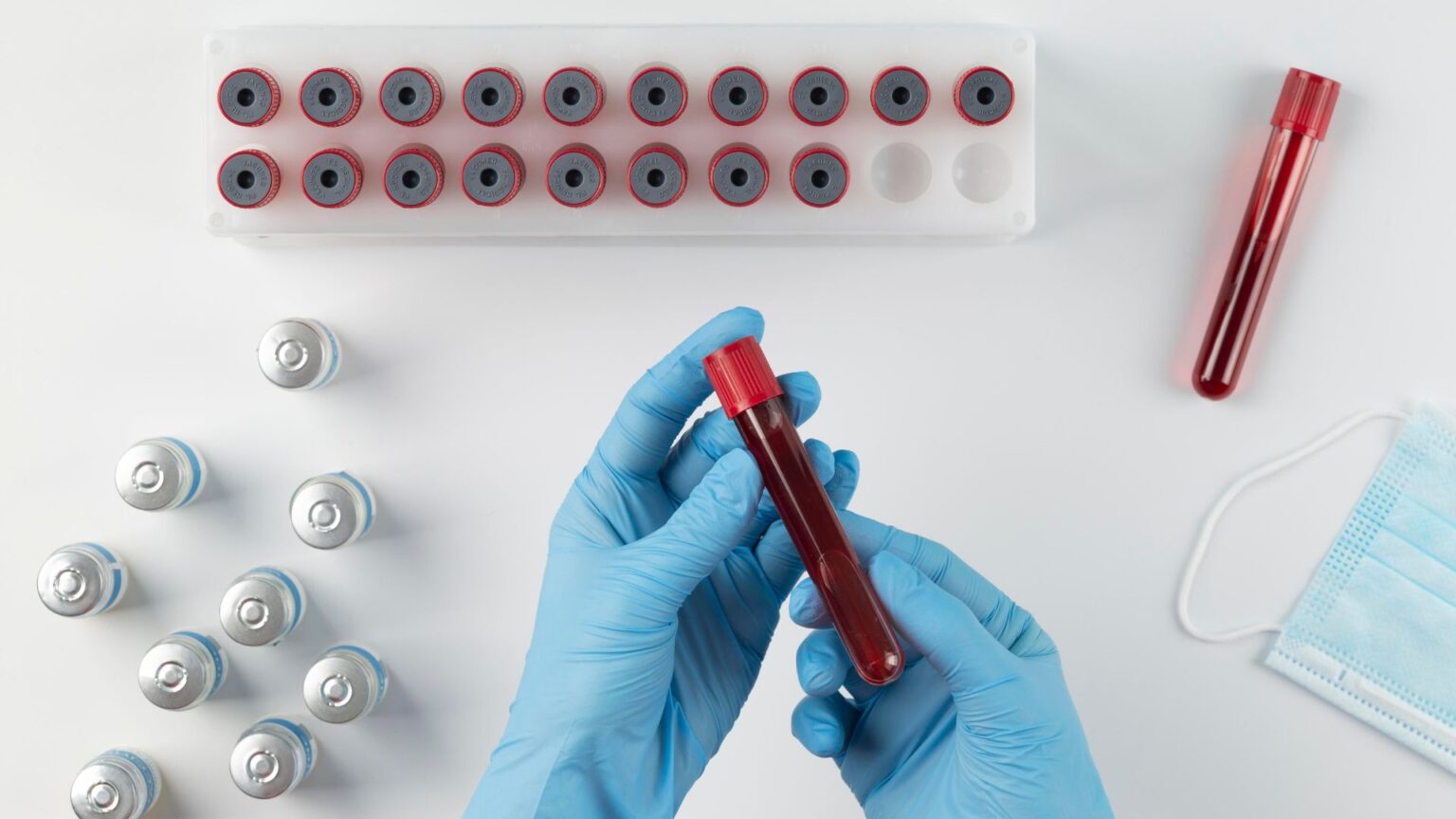 Check-ups: qual a importância de realizá-los? – Laborcentro
